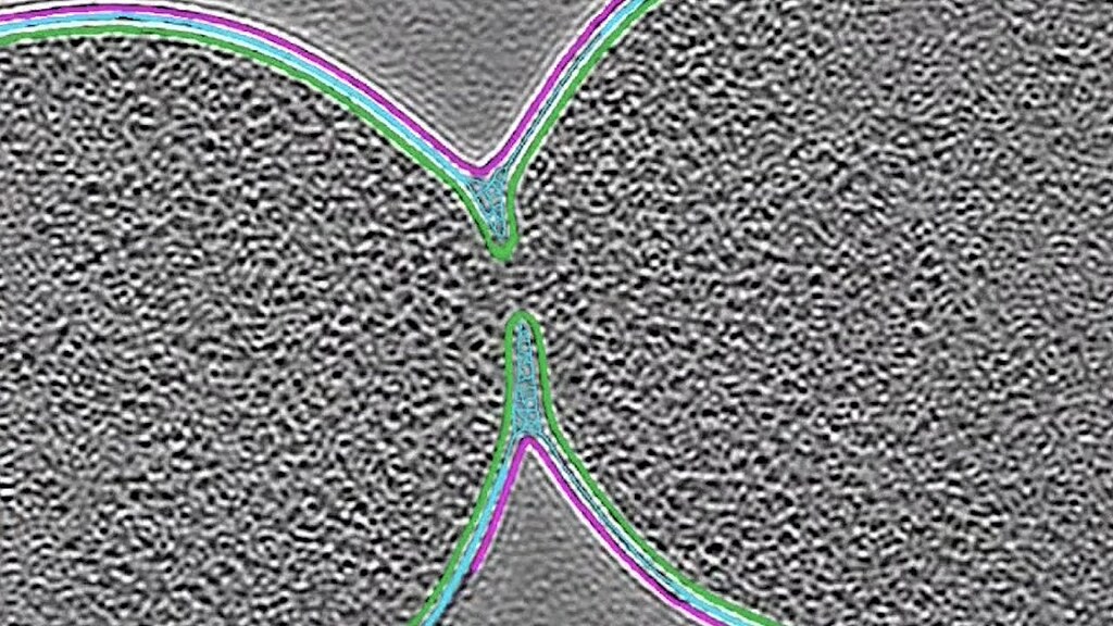 Imaging Cell Membranes During Cell Division - Tracking with Closeups ...
